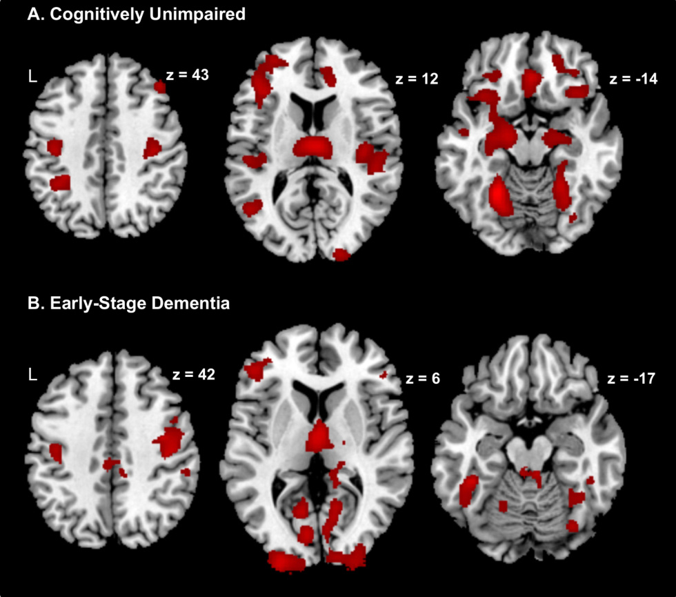About Us|Dementia Research Centre Singapore